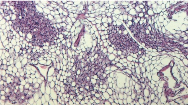 Purina inosina, la nueva molécula capaz de quemar grasa